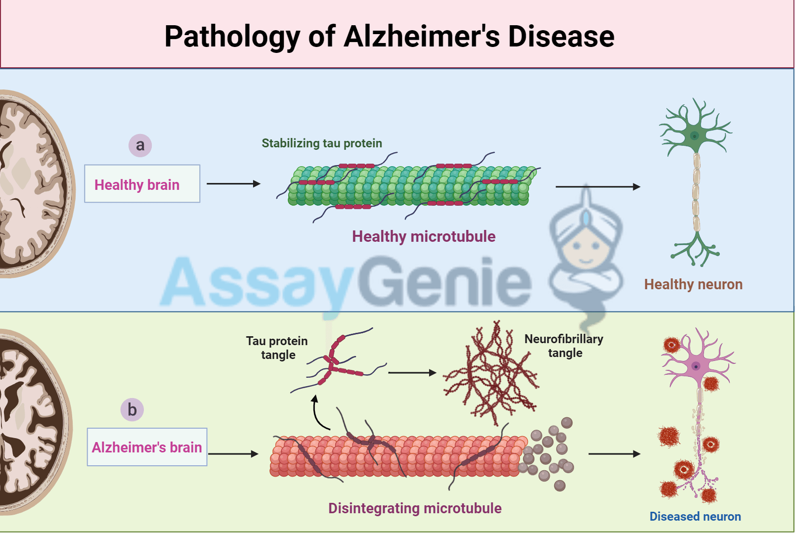 Alzheimer's Disease: A Comprehensive Insight - Assay Genie