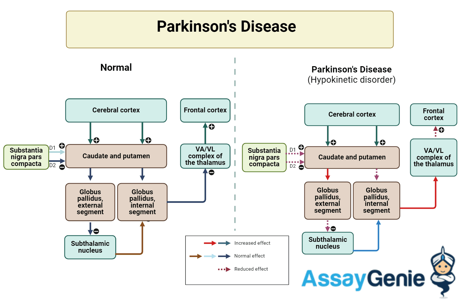 Understanding Parkinson's Disease: Insights and Innovations - Assay Genie