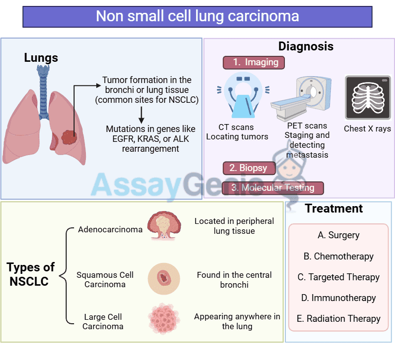 Non-Small Cell Lung Carcinoma: Understanding, Diagnosing, and Treating ...