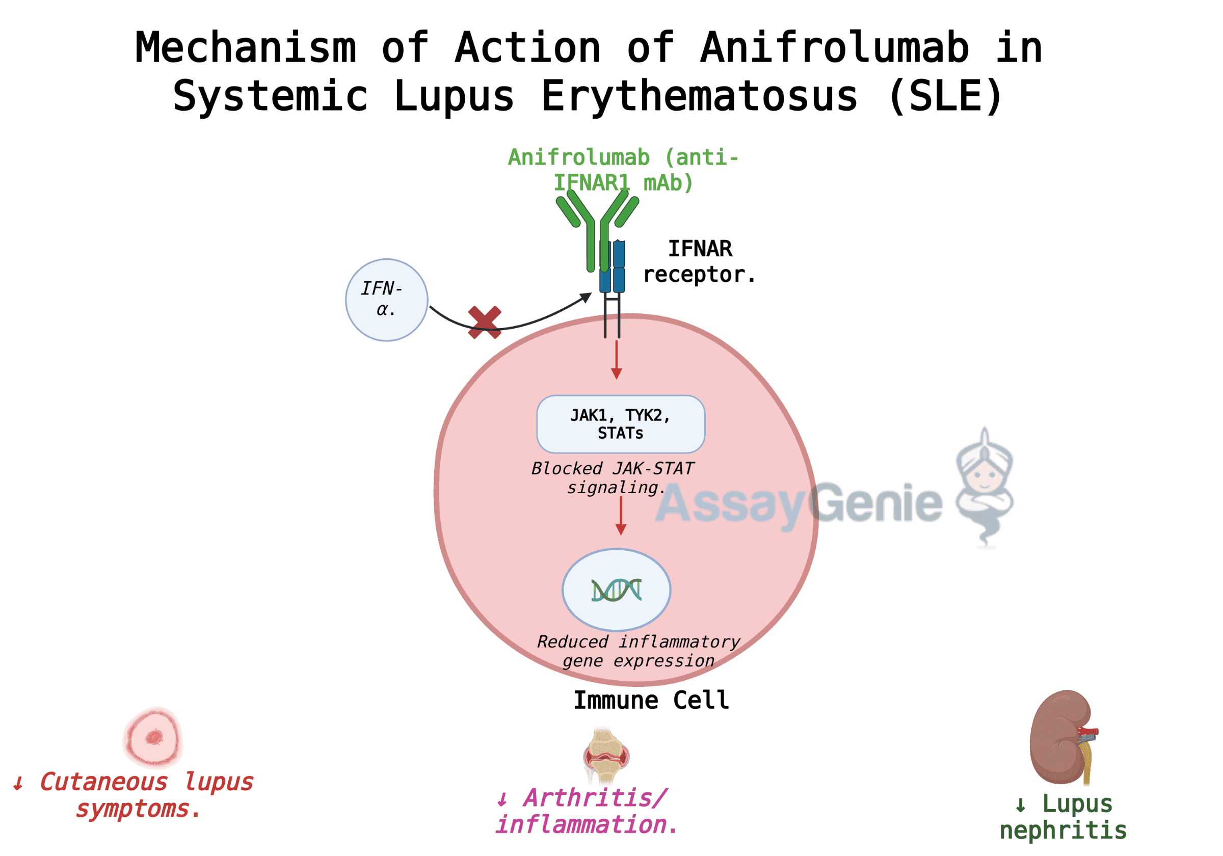 Anifrolumab: Transforming Lupus Treatment with Targeted Immunotherapy ...