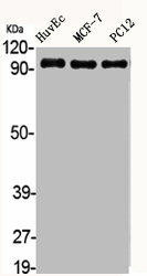 Anti-ACTN2/ACTN3 Antibody (PACO06231) | WB, IHC, IF