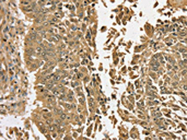 TGM6 Antibody (PACO20749)