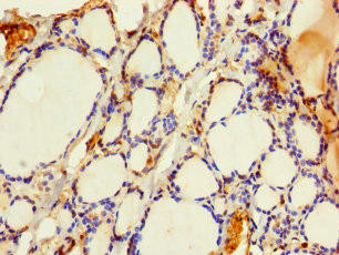 PRELID3B Antibody - Human ELISA, IHC | Assay Genie