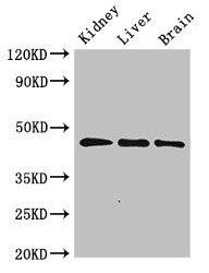 Anti-PIPOX Antibody (PACO51046) | WB, IHC
