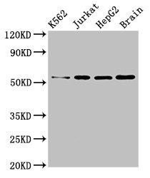 Anti-SLC16A8 Antibody (PACO51954) | WB, IHC, IF