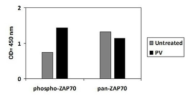Human Phospho-ZAP70 (Y493) PharmaGenie ELISA Kit (SBRS2020)