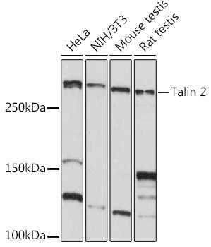 Anti-Talin 2 Antibody | Suitable for WB IHC IF Applications