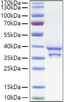 Human CCL17/TARC Protein | Assay Genie