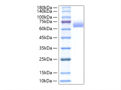 Recombinant Mouse Alkaline phosphatase (Intestinal type)/ALPI Protein ...