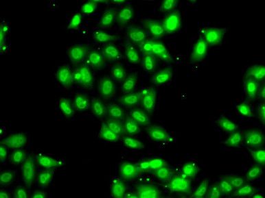 PIAS3 Antibody (CAB13394)