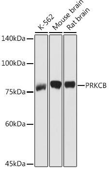 PRKCB Antibody - Human,Mouse,Rat | Assay Genie