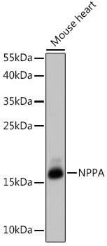 NPPA Antibody - Mouse,Rat WB, IHC-P, ELISA | Assay Genie