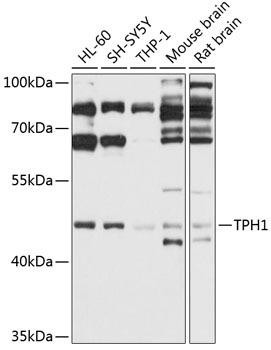 TPH1 Antibody - Human,Mouse,Rat WB, ELISA | Assay Genie