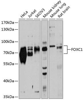 Anti-FOXC1 Antibody (CAB2924) | WB, IHC