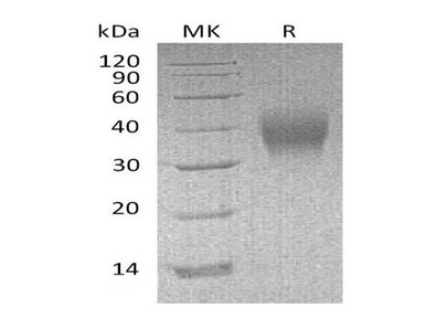 Mouse CD16/FCGR3 Recombinant Protein (His Tag) (Active) (RPES0226)