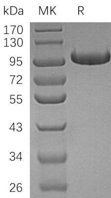 Human Complement Factor B/CFB Recombinant Protein (His Tag) (RPES0897)