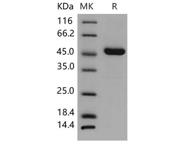 Mouse AGER/RAGE Recombinant Protein (His Tag) (Active) (RPES2505)