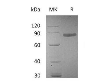 Human Transferrin Recombinant Protein (His Tag) (RPES3190)