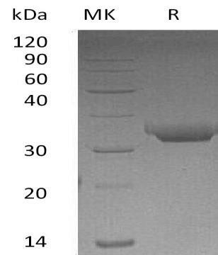 Human Recombinant Proteinase 3/PRTN3 Recombinant Protein (His Tag ...