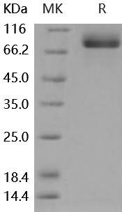 Mouse MEP1A/PPHA Recombinant Protein (His Tag) (Active) (RPES3915)