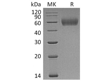 Human IL1R2/CD121b Recombinant Protein (His Tag) (RPES4581)