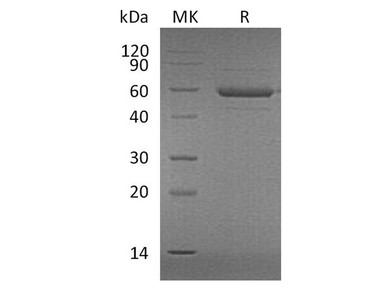 Human APRIL/TNFSF13 Recombinant Protein (His & Flag Tag) (RPES4955)