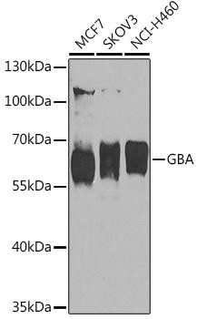 Glucosylceramidase beta (GBA) Antibody (CAB16860)
