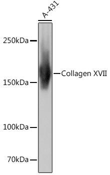 Collagen XVII/COL17A1 Antibody - Human | Assay Genie