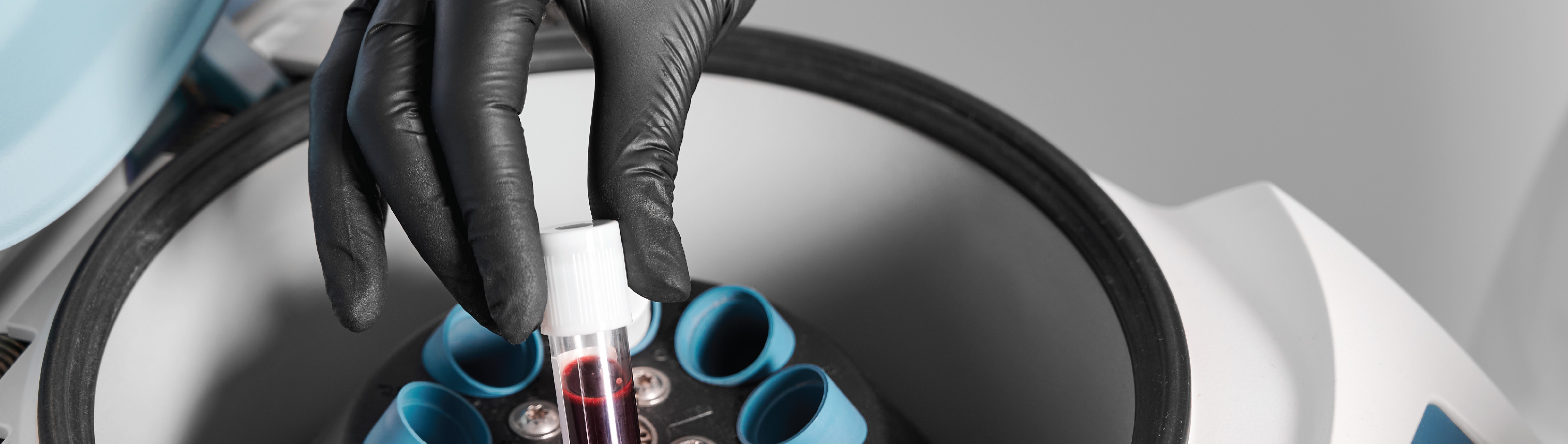 From Evidence to Efficiency: What a Recent Study Reveals About Nucleic ...