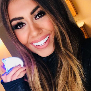 BleachBright Teeth Whitening Supplier — Light Up Your Smile