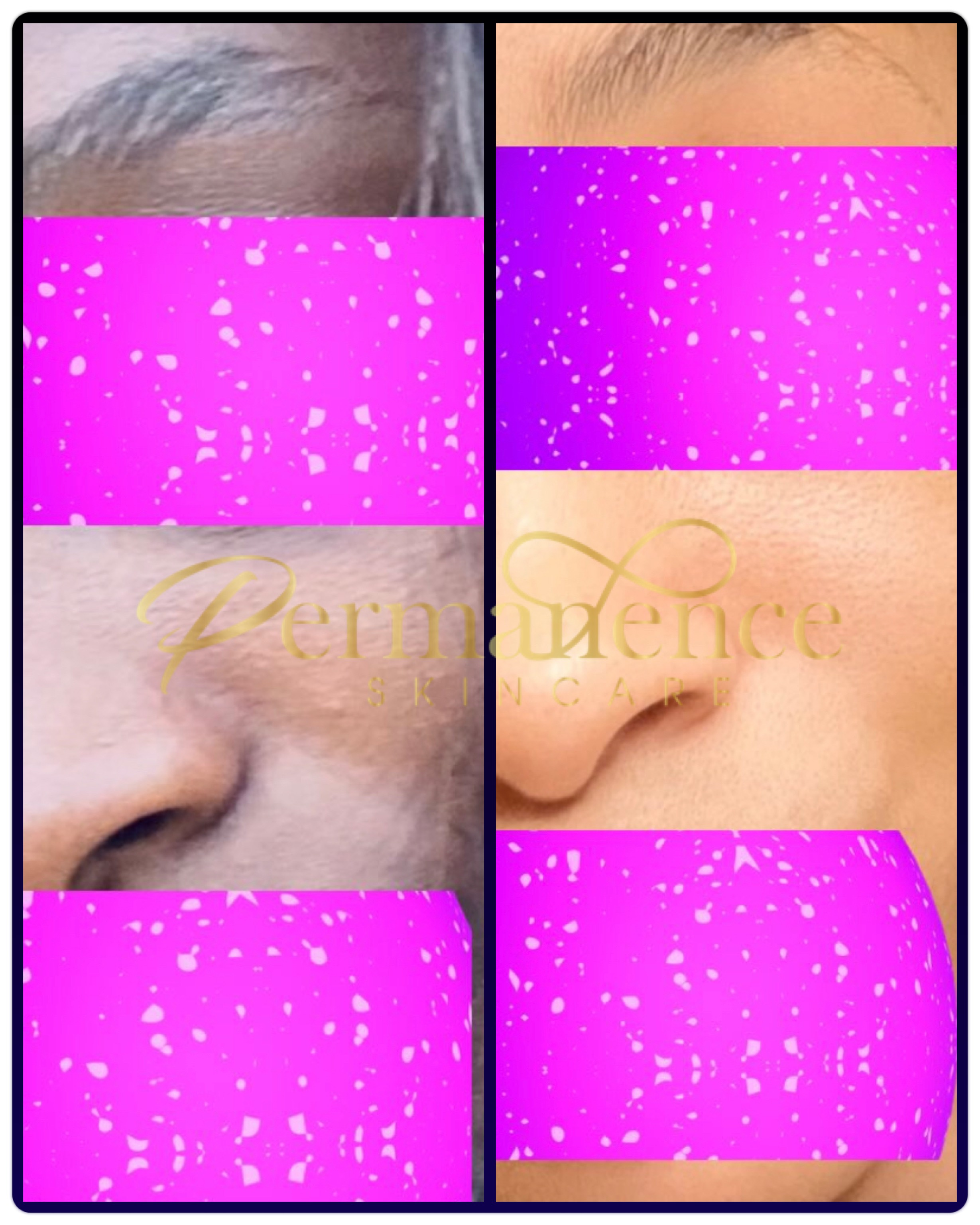 Permanence Skincare
