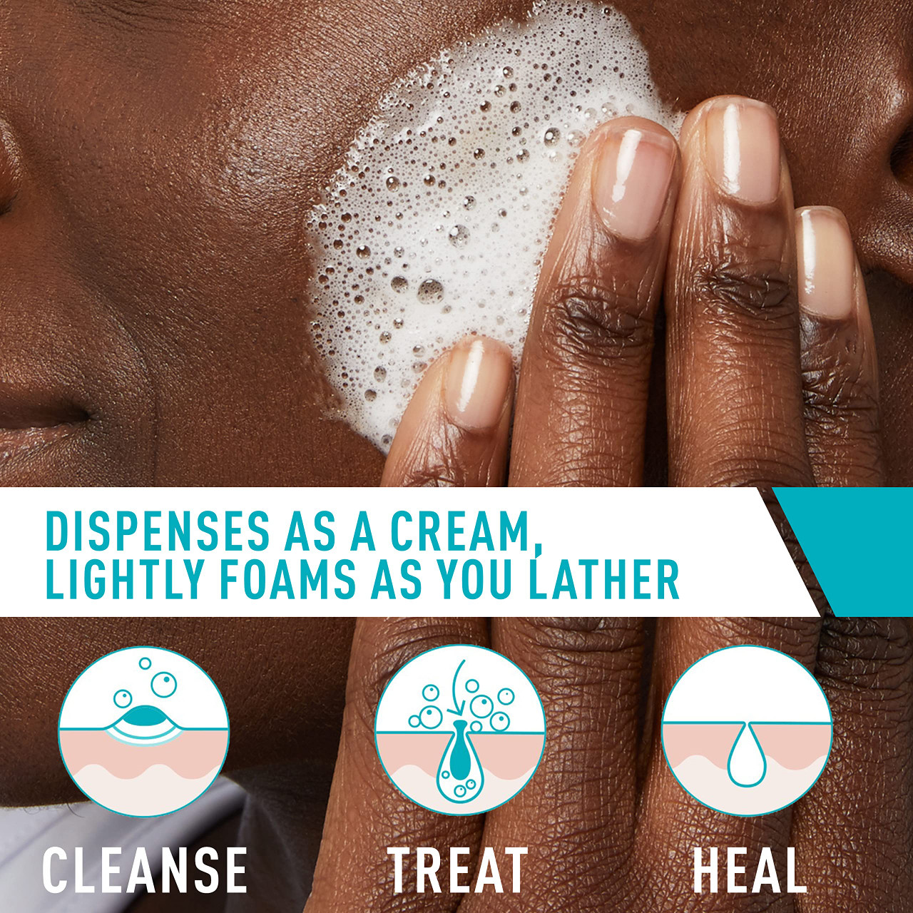 Cerave acne foaming cream cleanser uk store