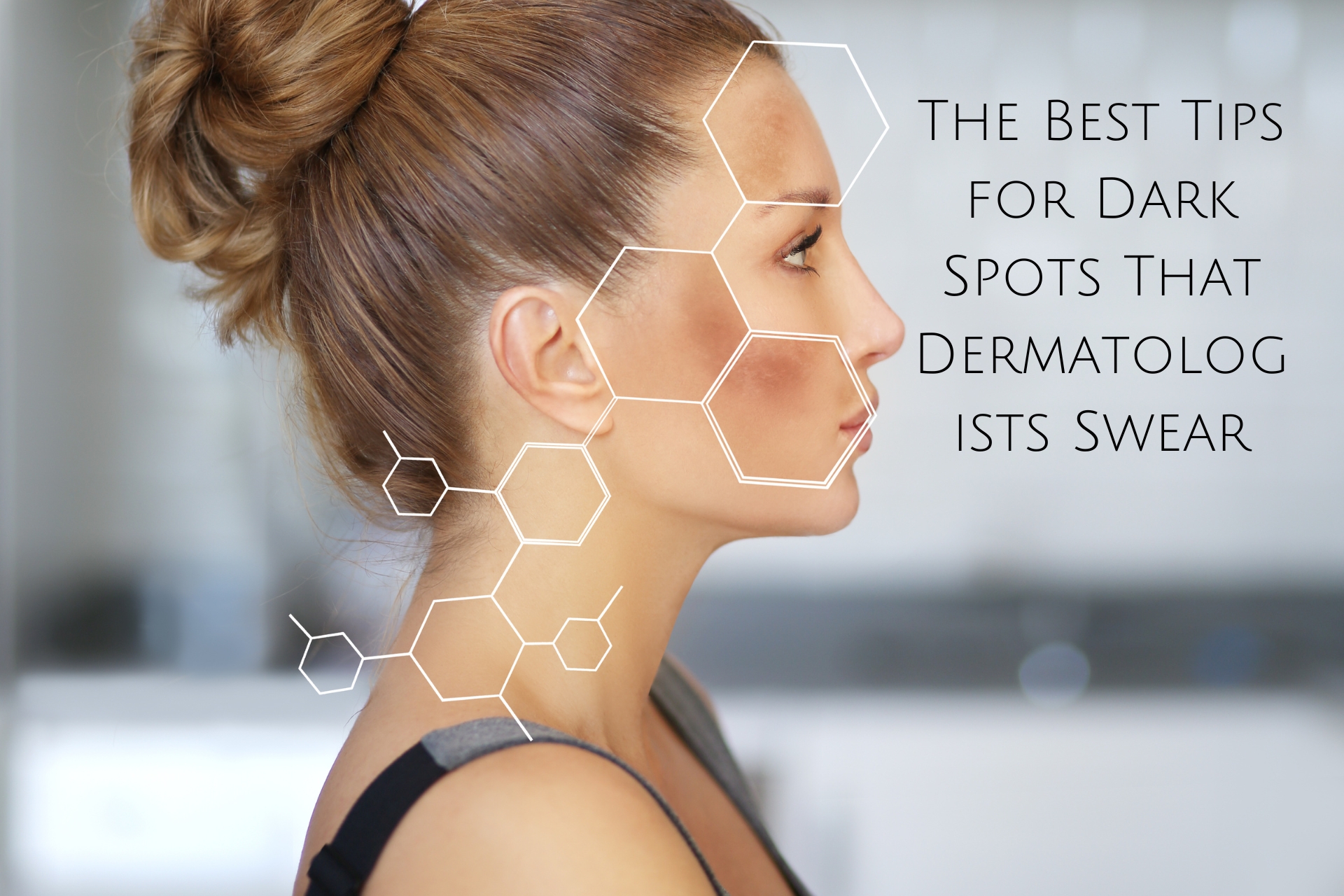 The Best Tips for Dark Spots That Dermatologists Swear - Kiwla