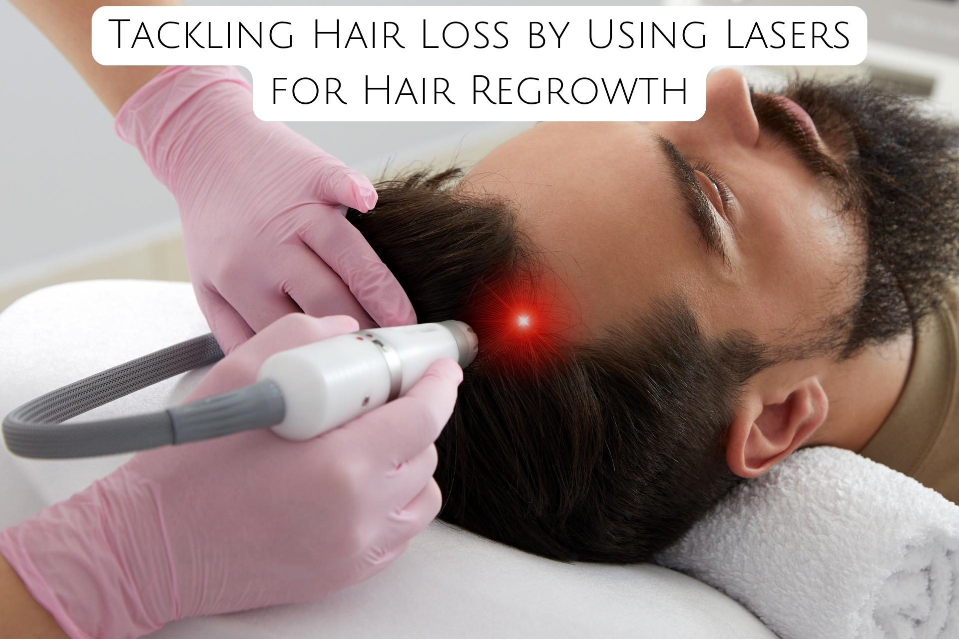 Tackling Hair Loss By Using Lasers For Hair Regrowth Kiwla