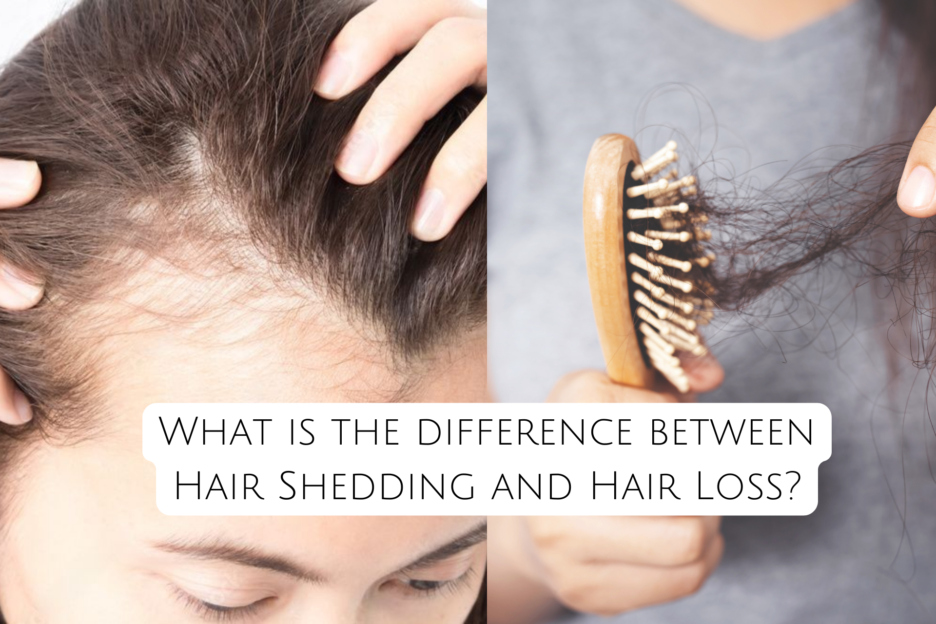 What is the difference between Hair Shedding and Hair Loss? - Kiwla