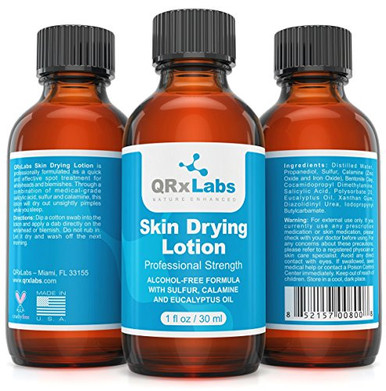 Drying Lotion - Alcohol- Overnight Acne & Whitehead Spot Treatment ...