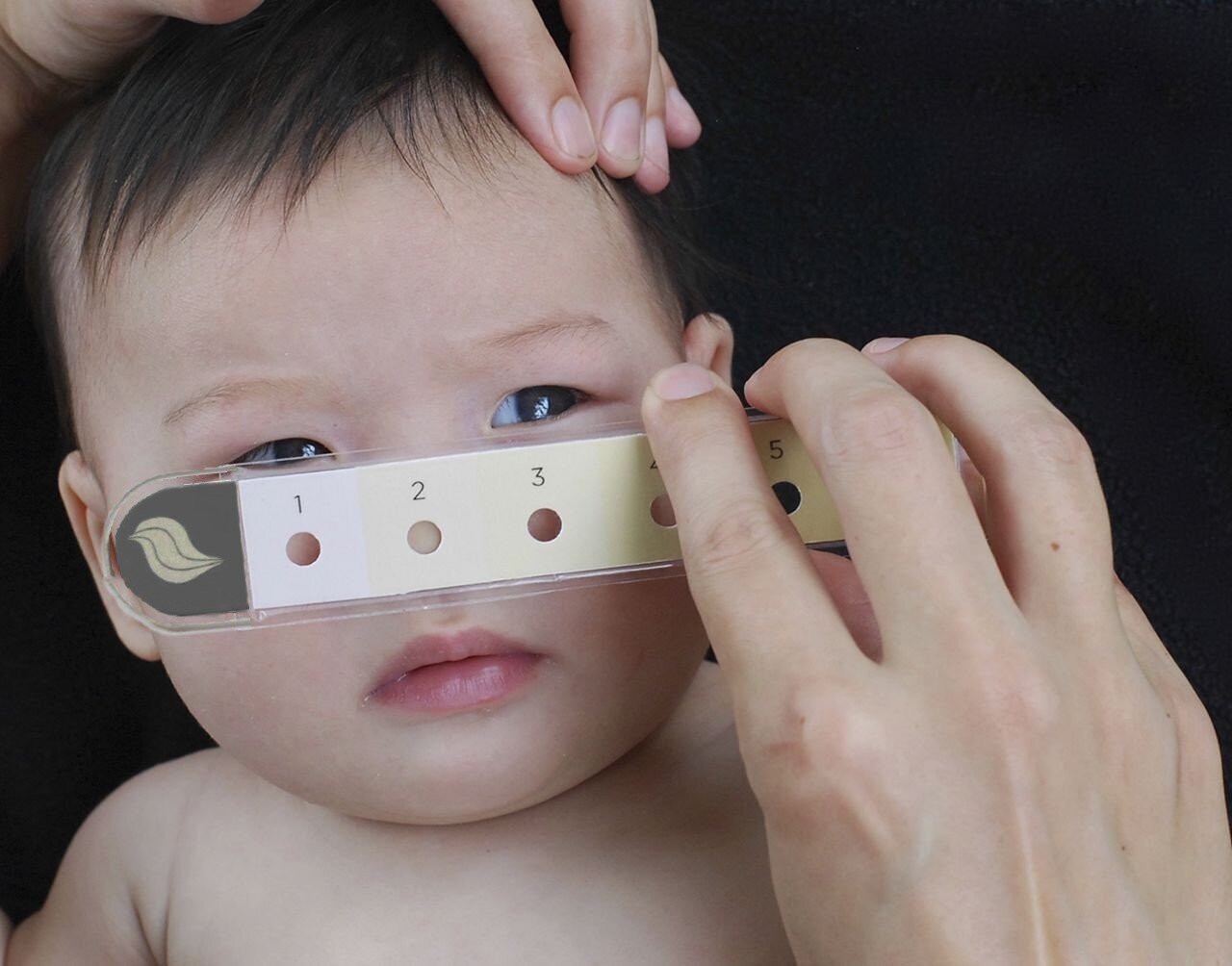 bili-ruler™ Icterometer Jaundice Screening Tool | Cascade Health Care