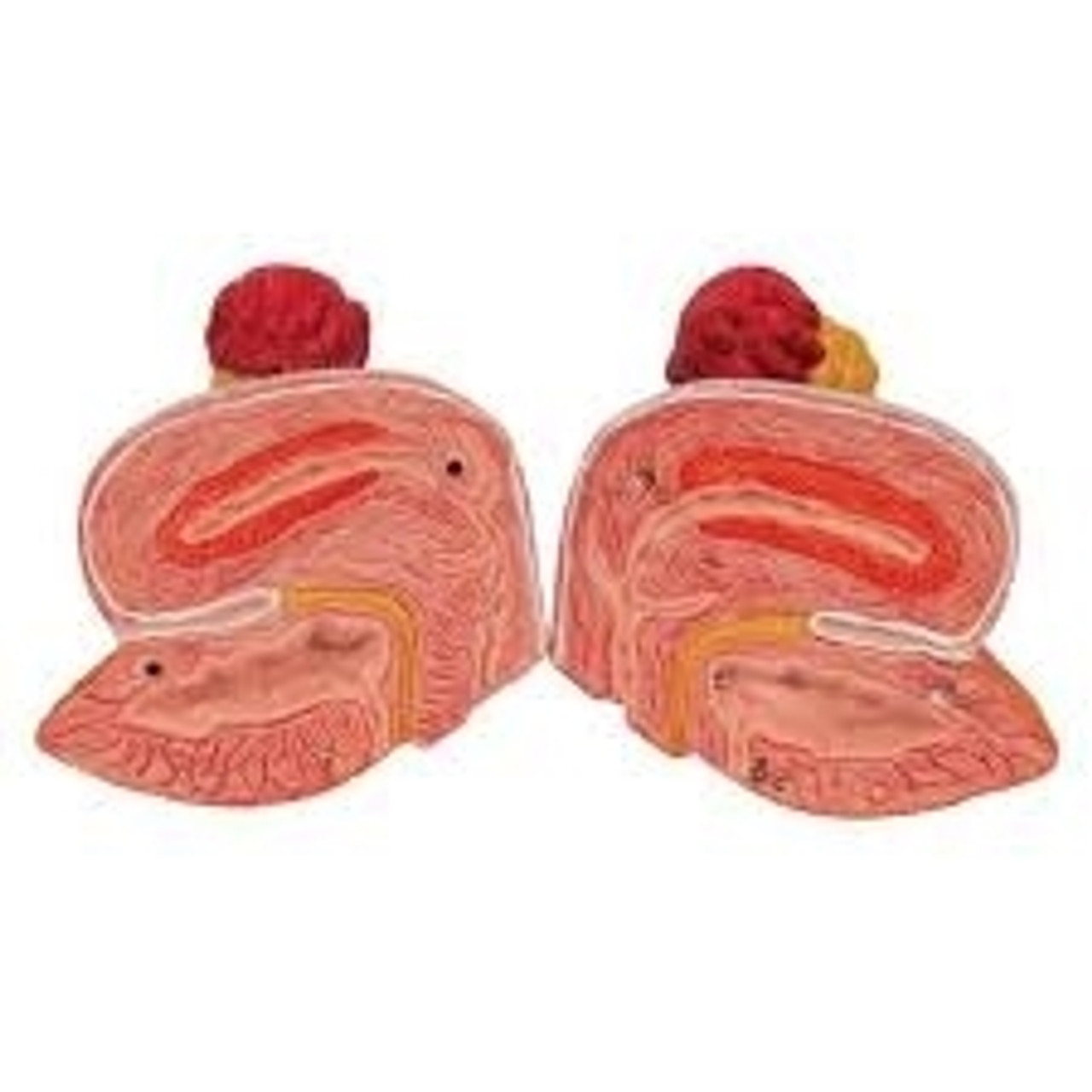 Dual Sex Urinary System