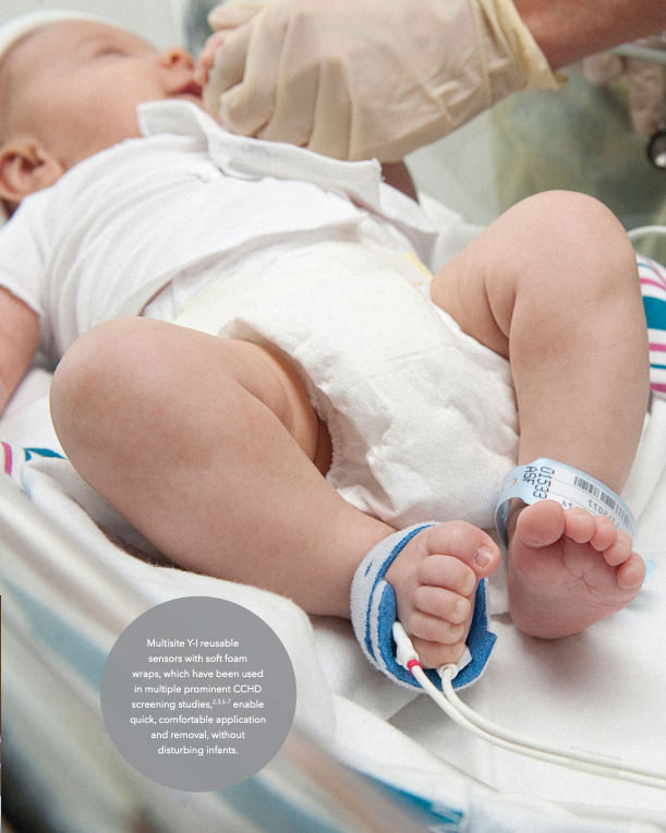 Masimo Rad-G Pulse Oximeter With Two Sensors