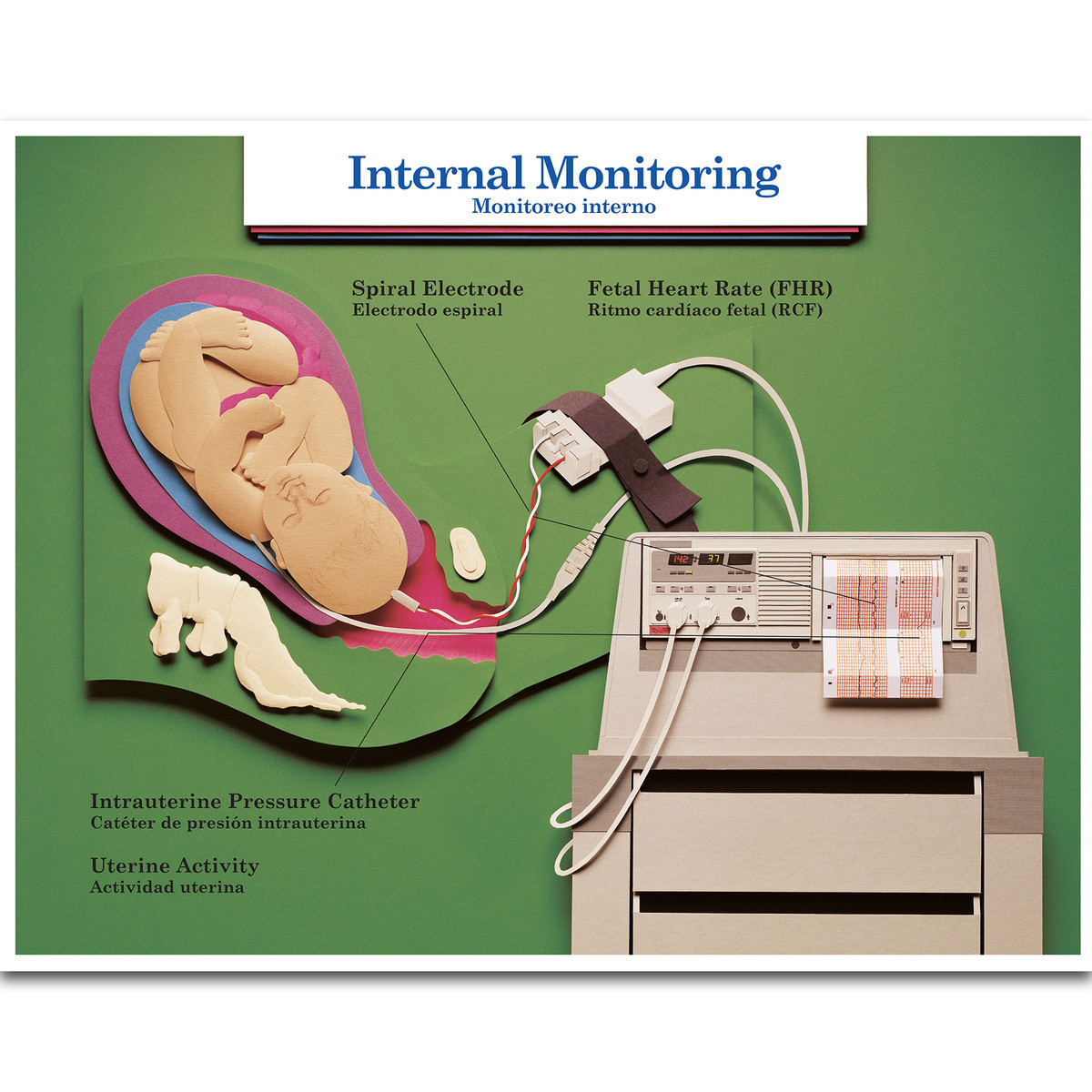 Labor & Birth Intervention Chart Set, Bilingual No Sales Tax Cascade ...
