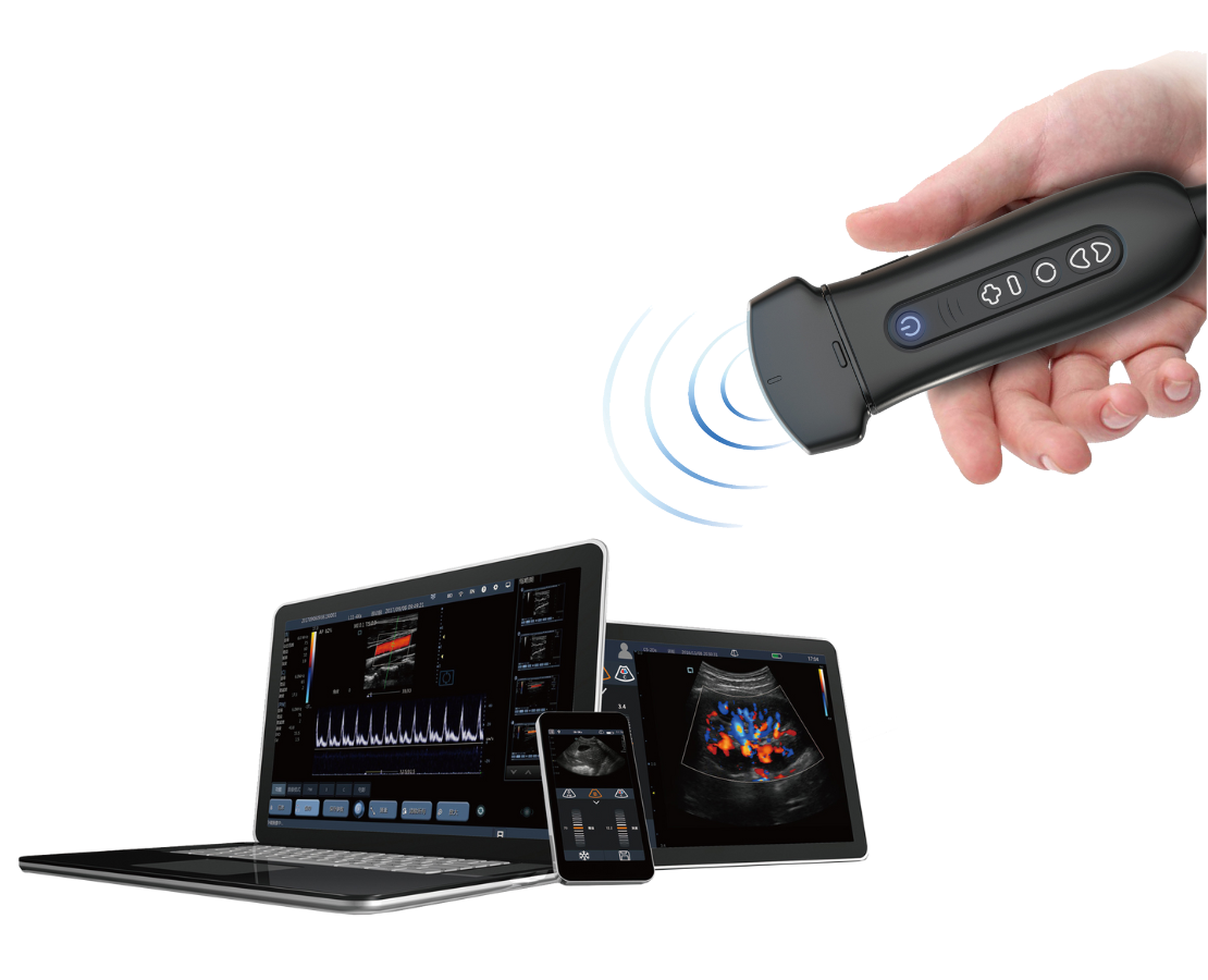 Youkey Soloscan P50 Ultrasound Scanner With Probe
