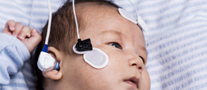 Madsen 1077 AccuScreen OAE Newborn Hearing Screening Device No Sales ...