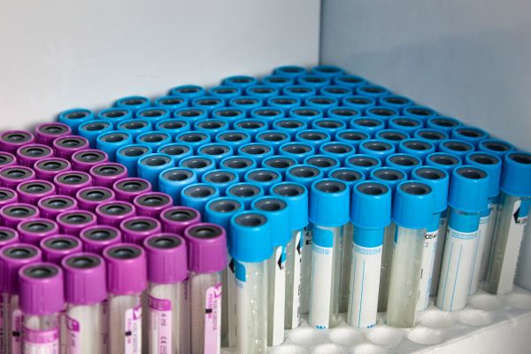 Everything You Need To Know About Vacutainers - Cascade Health Care Inc.