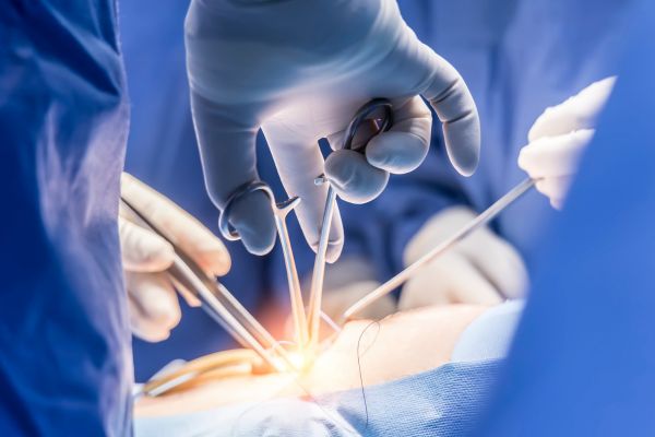 The Different Types of Surgical Needle Holders - Cascade Health Care Inc.