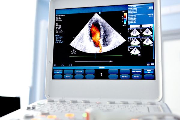 4 Things To Know About Color Doppler Ultrasound - Cascade Health Care Inc.