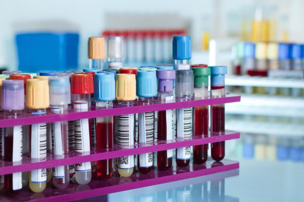 Mistakes To Avoid When Labeling Specimens - Cascade Health Care Inc.