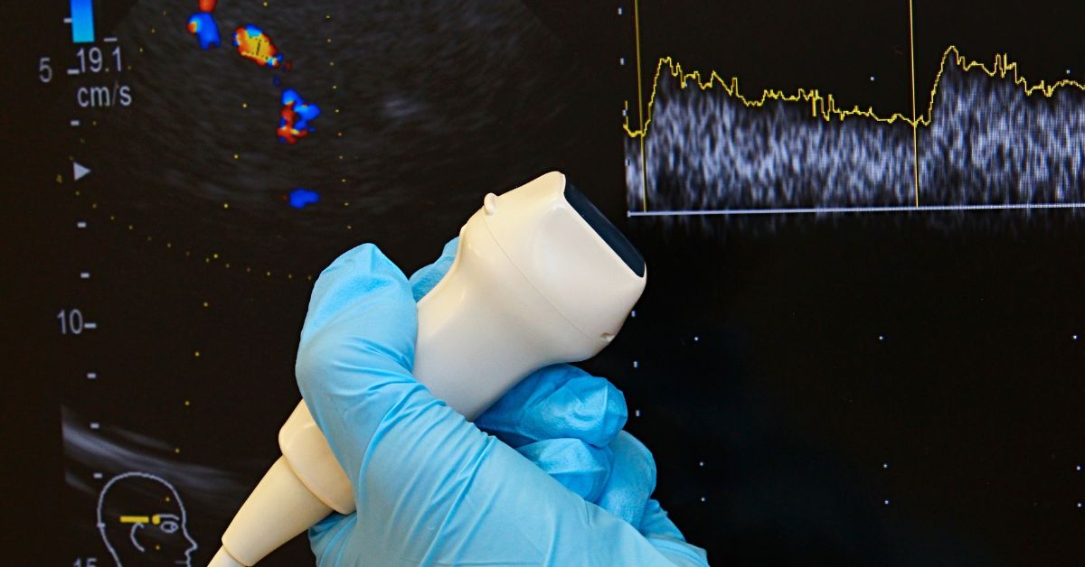 How Dopplers Work and How To Properly Use Them - Cascade Health Care Inc.