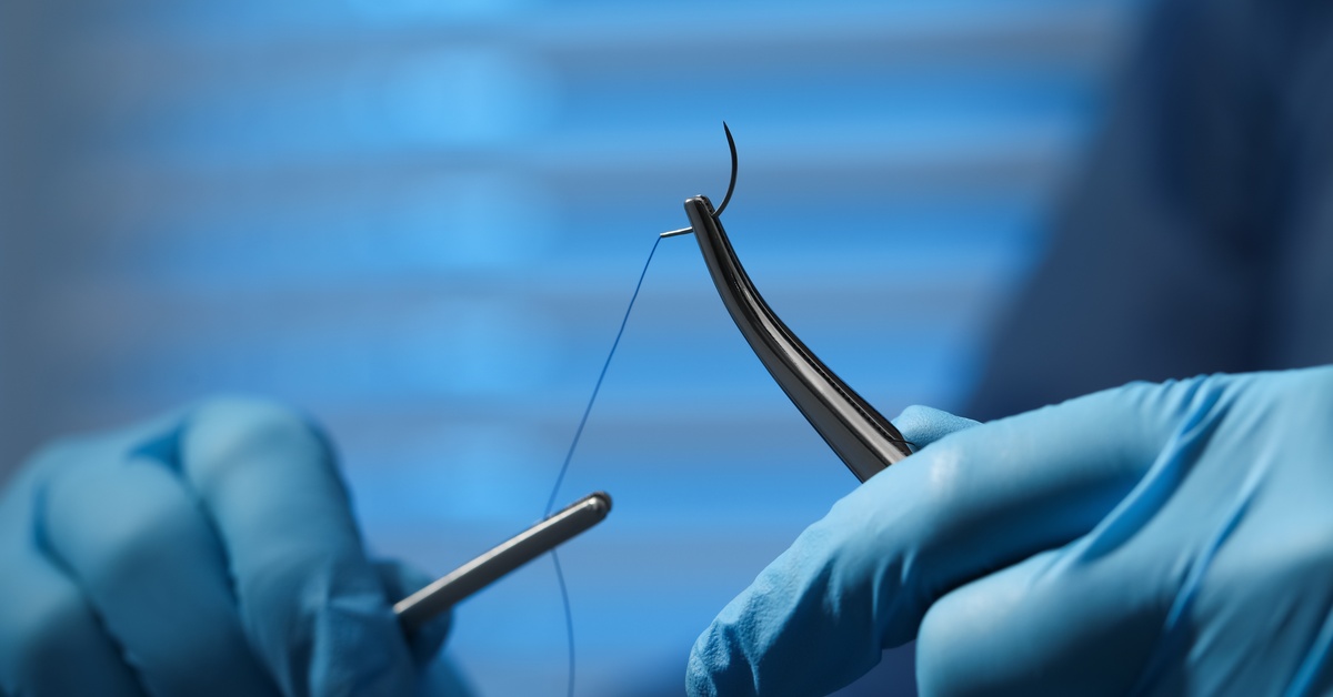 What Midwives Need To Know About Suturing - Cascade Health Care Inc.