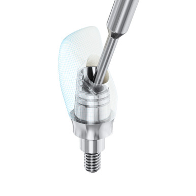 CAD/CAM Ti-Base | Angled Access | Concave Profile | Rotational