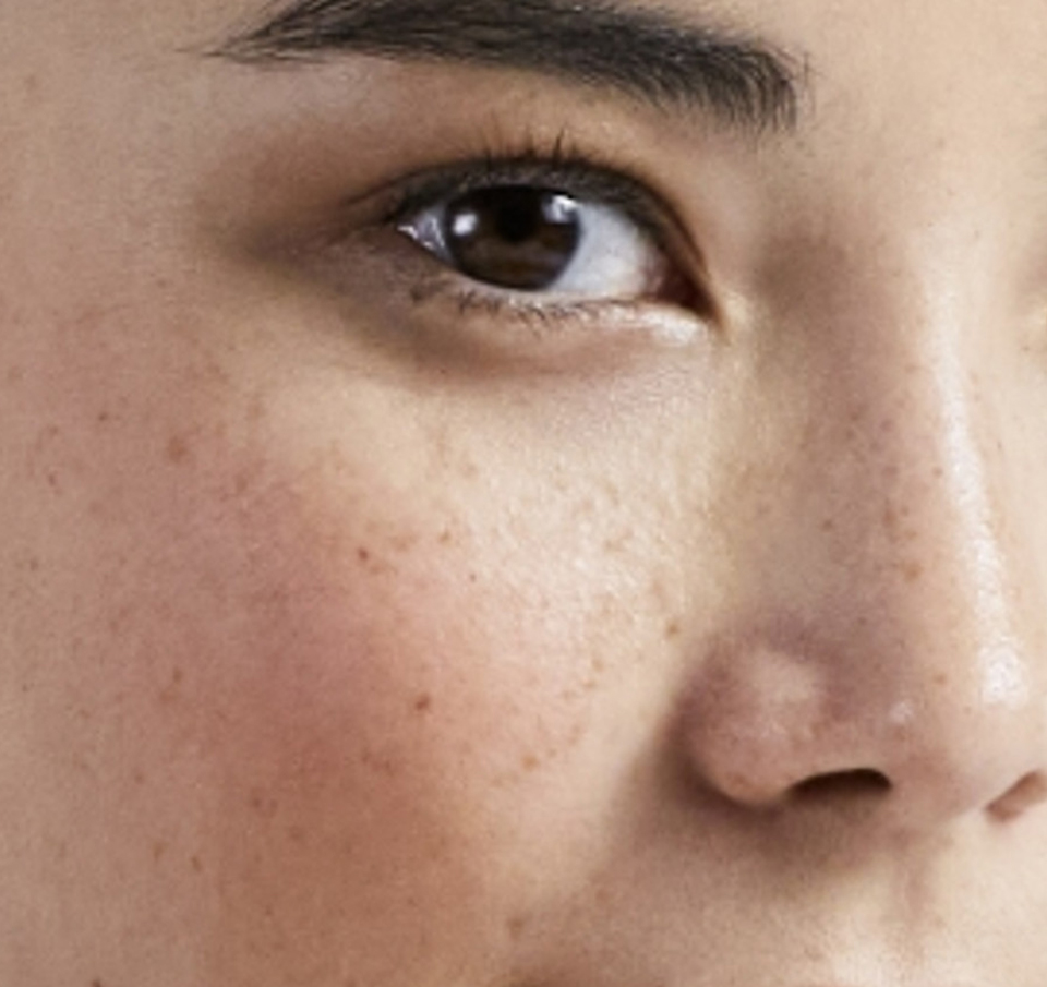 How to maintain skin results when taking Skin Accumax™ - Advanced ...